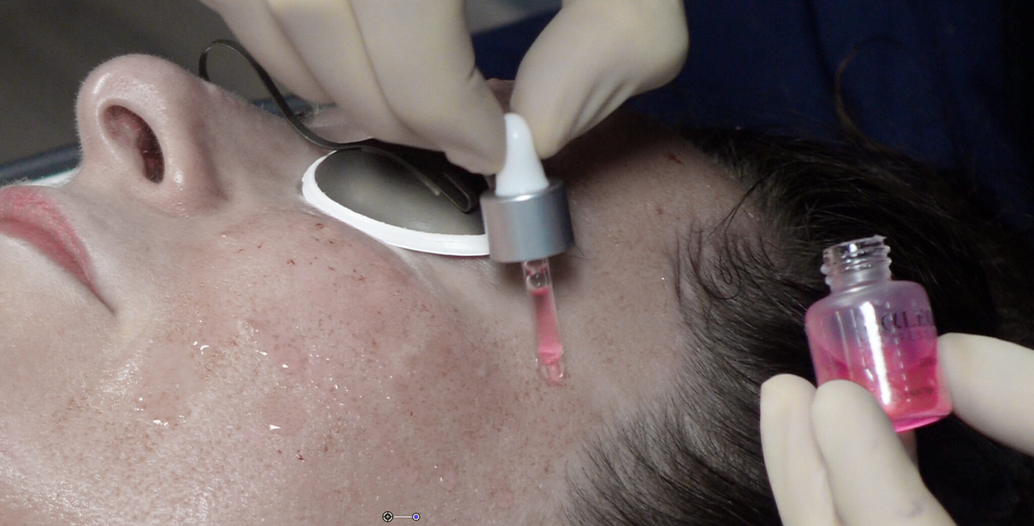 Malar Bags in London - Bayati Clinic